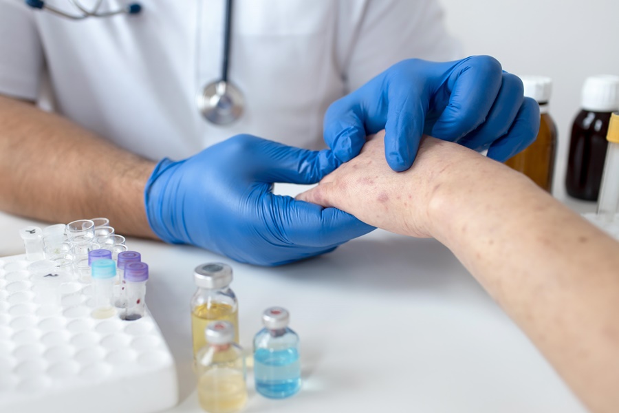 Overview of Skin Allergy: Symptoms, Diagnosis, and Treatment