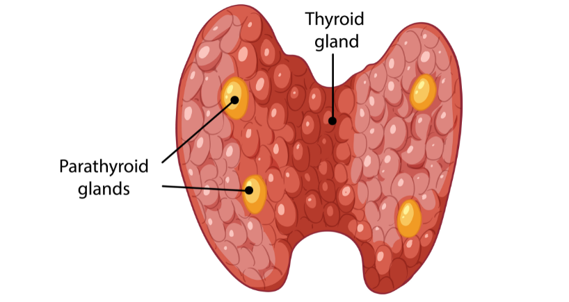 Fibromuscular Dysplasia (FMD): An In-Depth Look at Diagnosis and ...