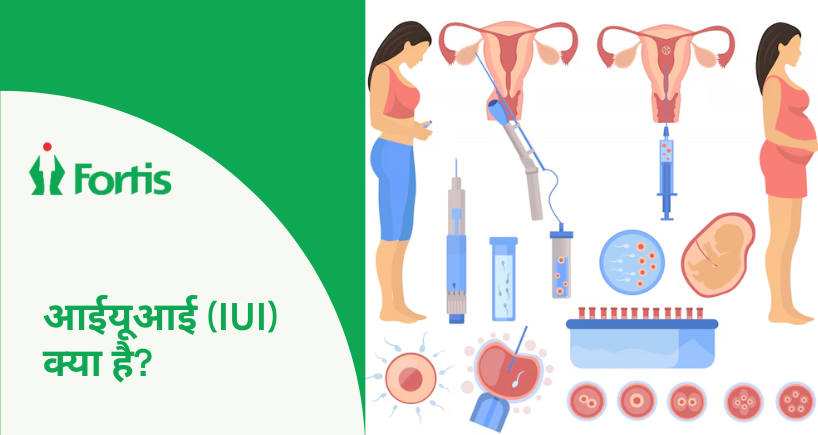 IUI बनाम IVF: कौन-सा प्रजनन उपचार है सही? जानें मुख्य अंतर