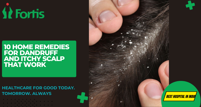10 Home Remedies for Dandruff and Itchy Scalp That Work