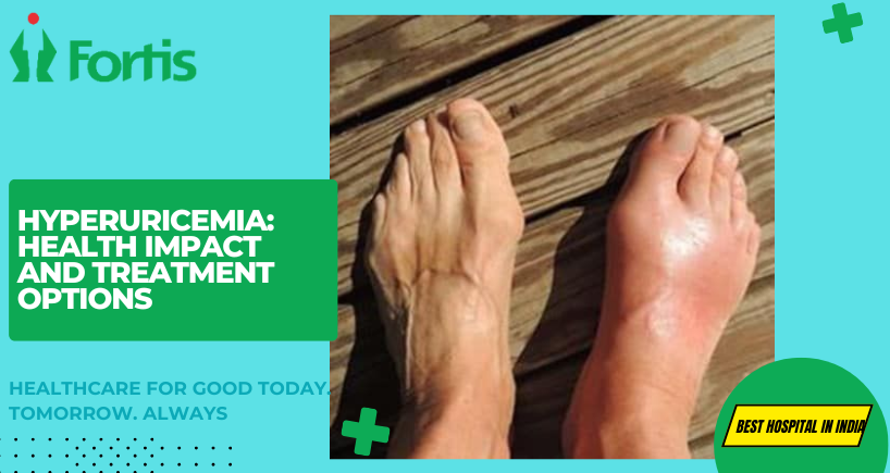Hyperuricemia: Health Impact and Treatment Options