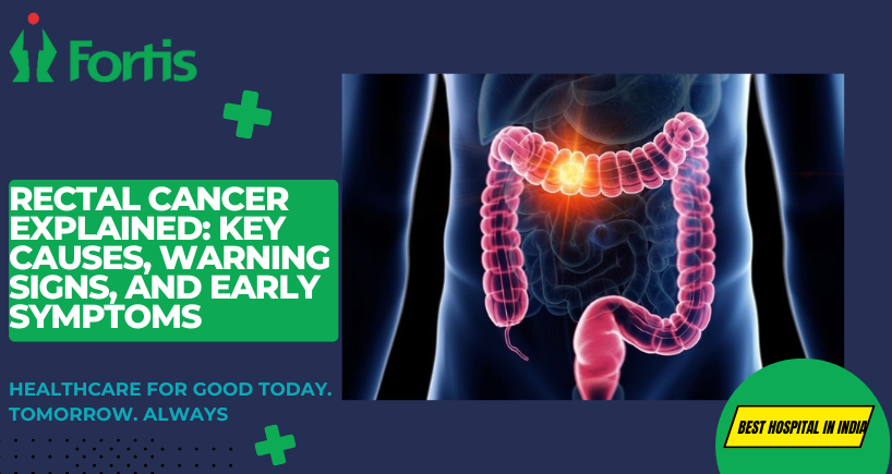 Rectal Cancer: Causes, Warning Signs, and Early Symptoms Explained