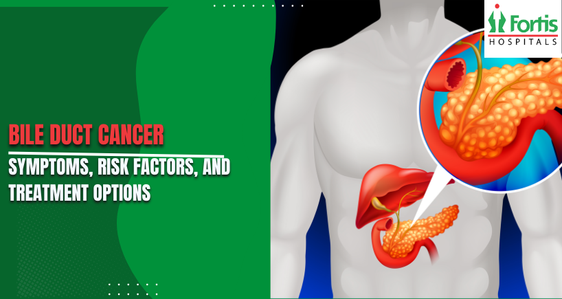 Bile Duct Cancer: Symptoms & Treatment Options