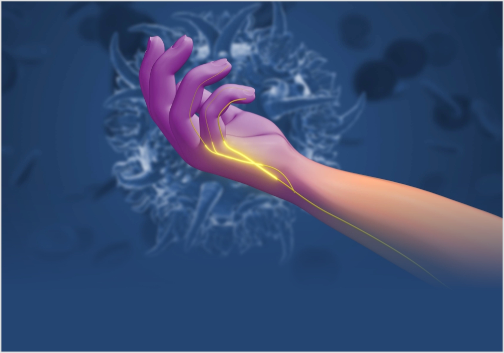 Guillain-Barre Syndrome: Symptoms, Causes & Treatment | Fortis Healthcare
