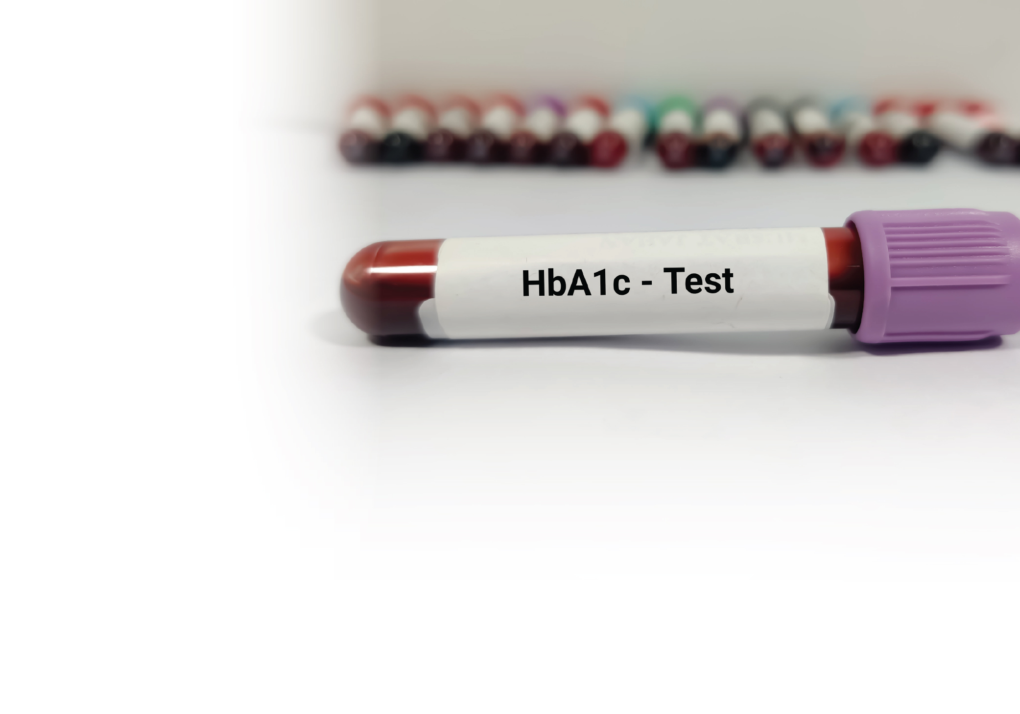 What is the HbA1c Test? A Complete Guide to Understanding Your Blood ...