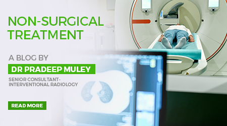 Non-Surgical Treatment | Fortis Health Connect Blogs