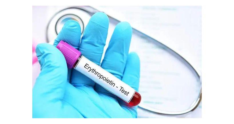 Managing Leukopenia: Evaluation And Treatment Strategies