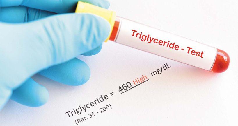 High Triglycerides: Essential Information